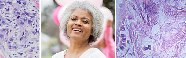 College of American Pathologists - Multidisciplinary Breast Pathology